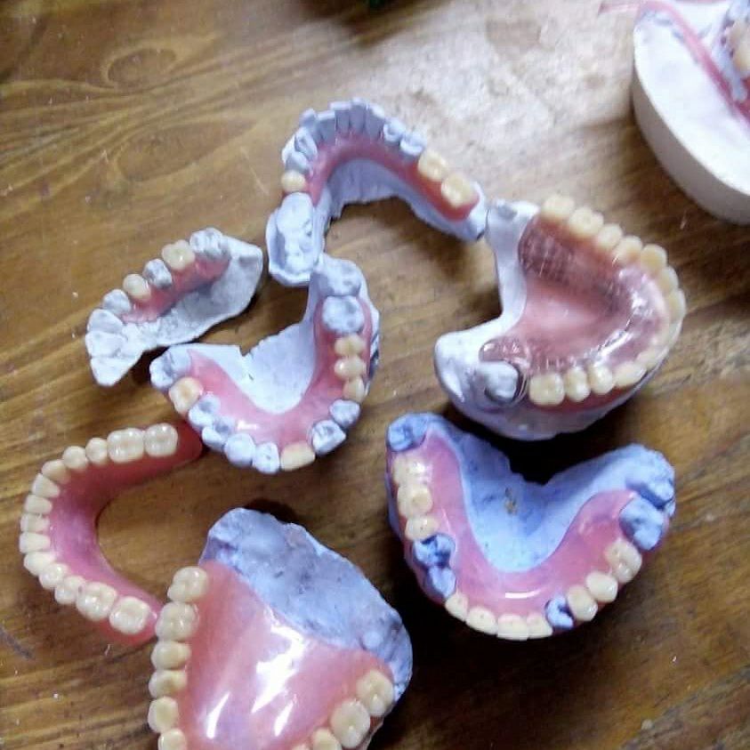 Valplast - "SMILE DENTAL" AHLI GIGI PALSU"SMILE DENTAL" AHLI GIGI PALSU