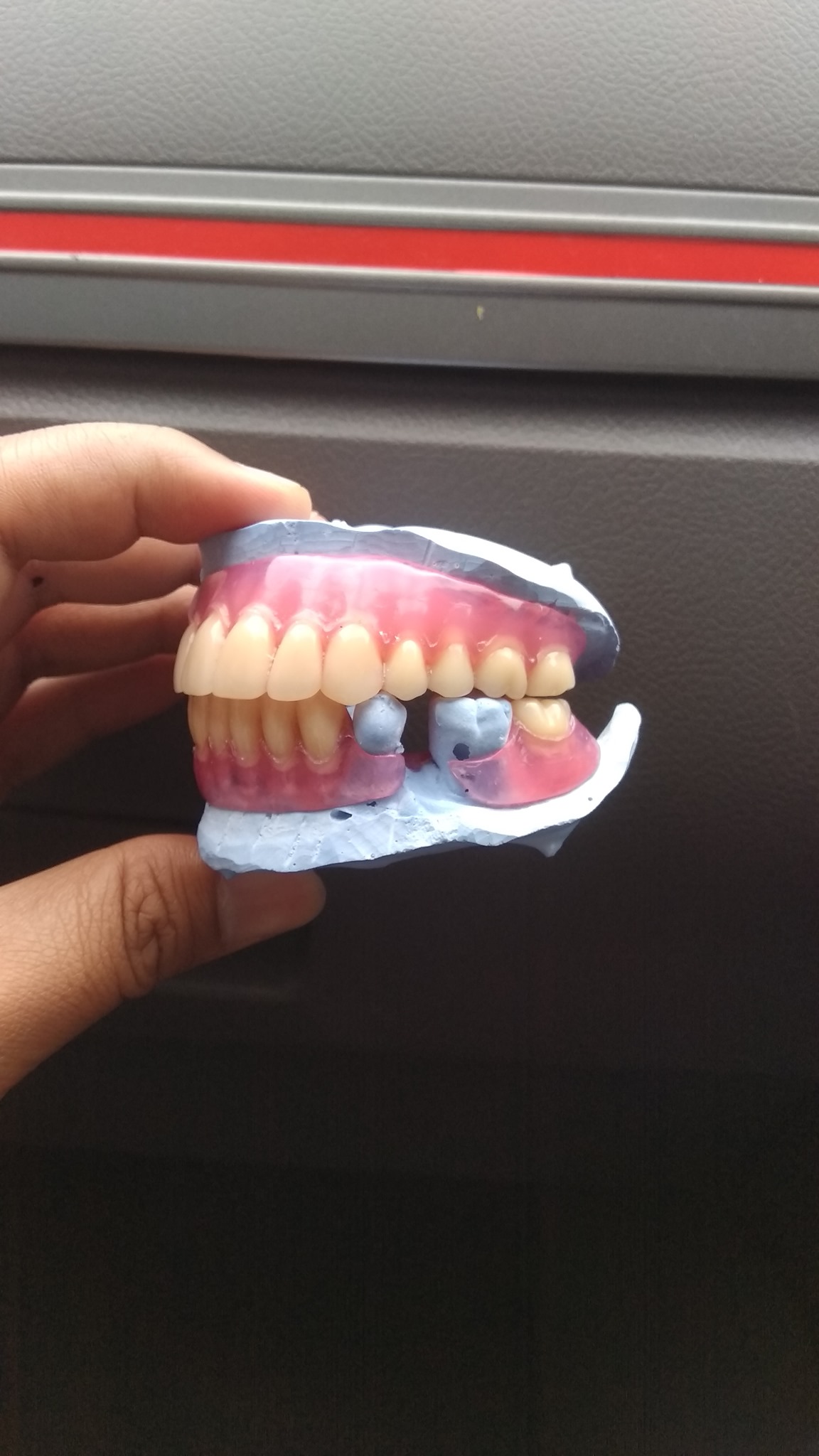 Valplast - "SMILE DENTAL" AHLI GIGI PALSU"SMILE DENTAL" AHLI GIGI PALSU