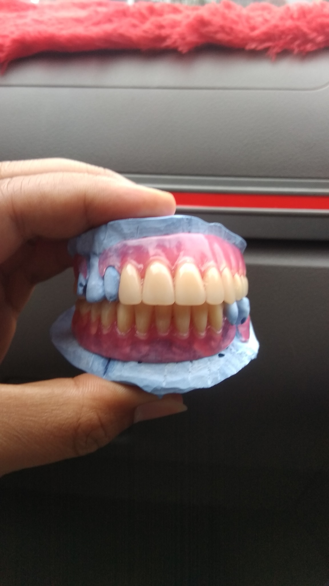 Valplast - "SMILE DENTAL" AHLI GIGI PALSU"SMILE DENTAL" AHLI GIGI PALSU